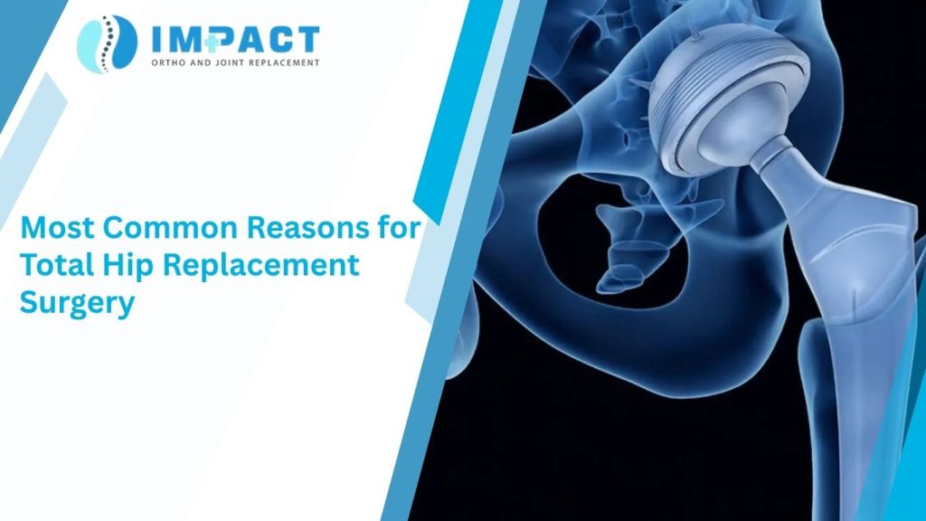 Most Common Reasons for Total Hip Replacement Surgery - Impact ...