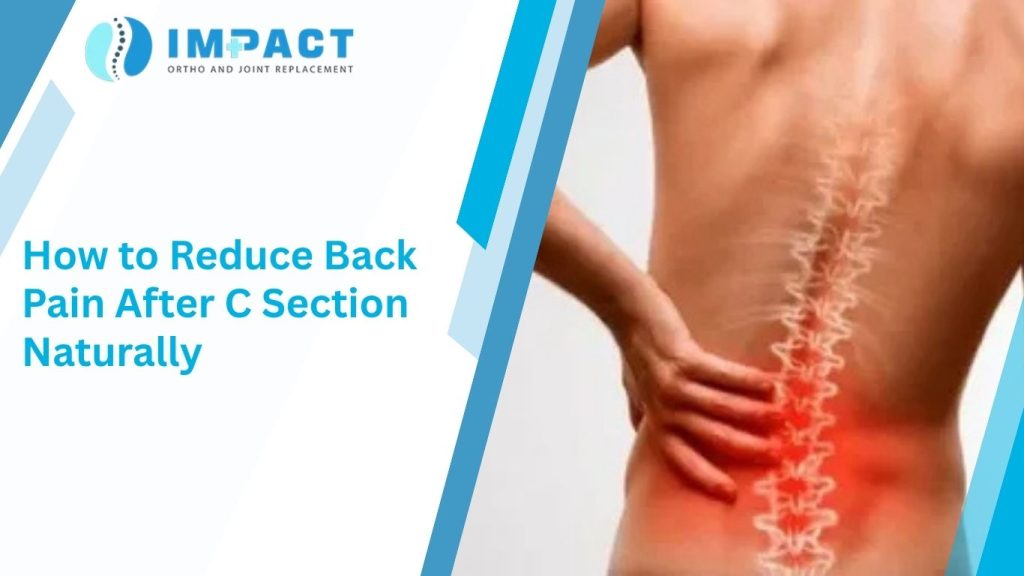How to Reduce Back Pain After C Section Naturally - Impact Ortho Center